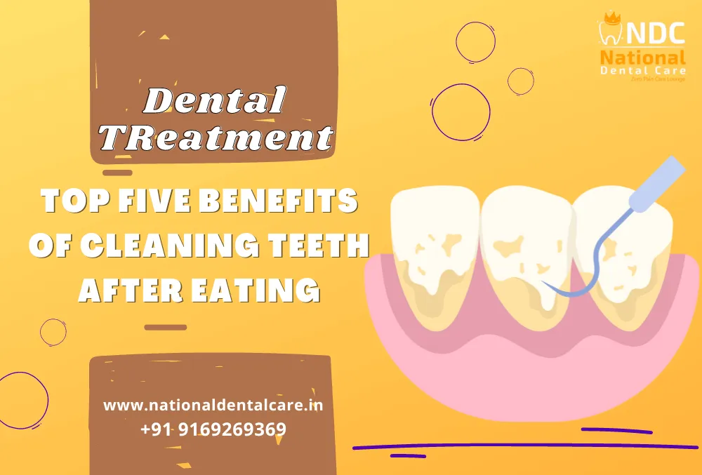 Top five benefits of cleaning teeth after eating