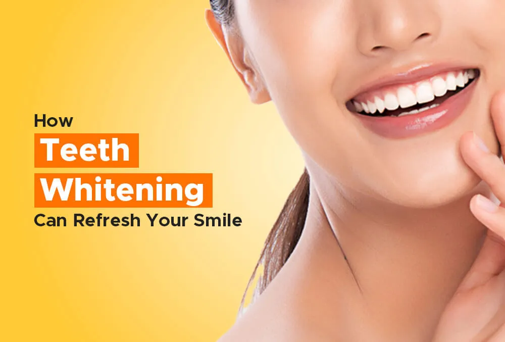 How Teeth Whitening Can Refresh Your Smile