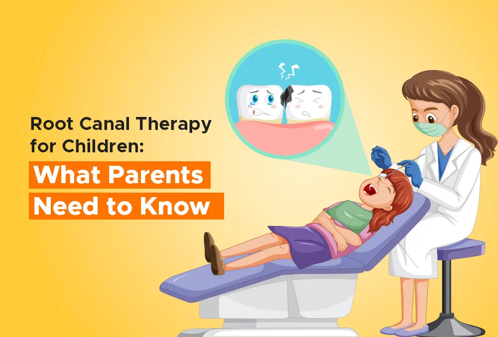 Root Canal Therapy for Children: What Parents Need to Know