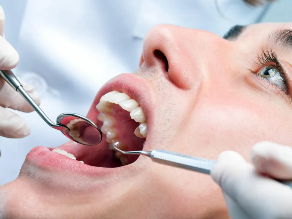 Root Canal Treatment in Hyderabad, India | Root Canal Near Me
