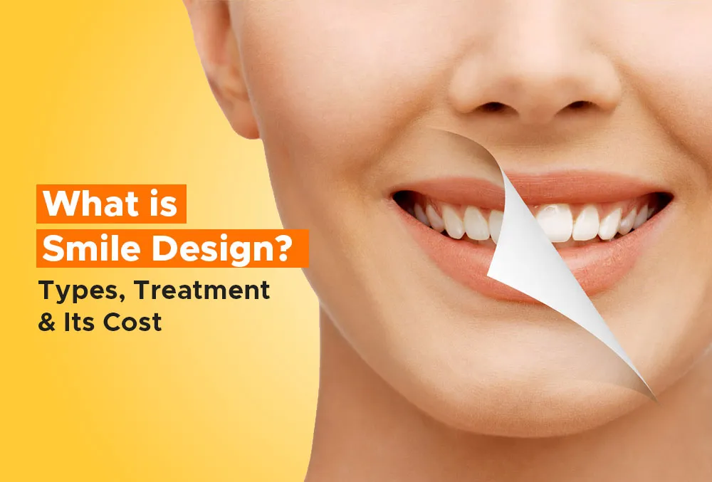 What is Smile Design? Types, Treatment & Its Cost