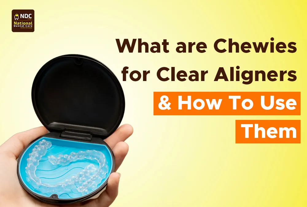 What are Chewies for Clear Aligners & How To Use Them