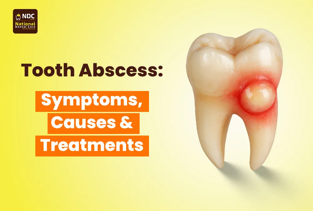 Abscess Swollen Cheek