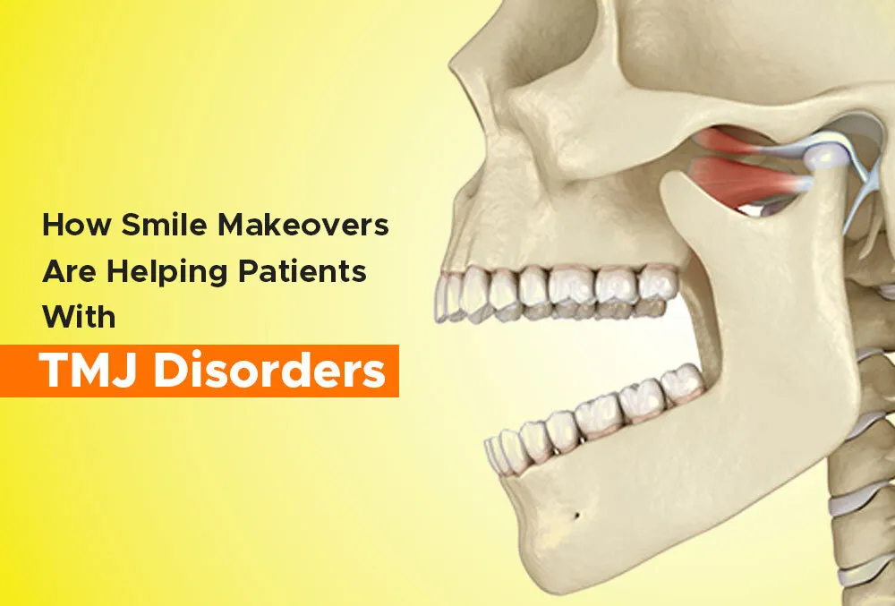 How Smile Makeovers Are Helping Patients With TMJ Disorders?