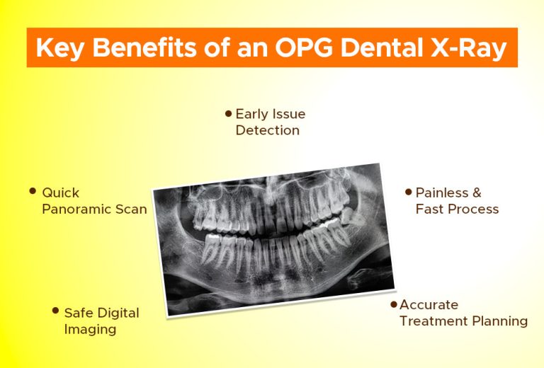 OPG Dental X-Ray Benefits and Process