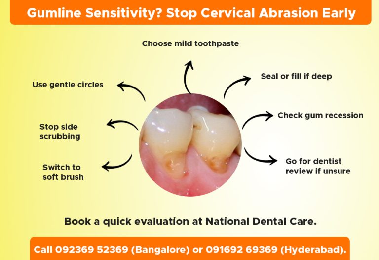 Tooth Cervical Abrasion, Causes, Treatment and Prevention